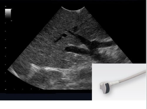 HITACHI ARIETTA PRECISION | MEDtechnic services s.r.o.