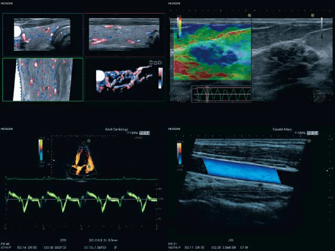HITACHI HI VISION AVIUS | MEDtechnic services s.r.o.