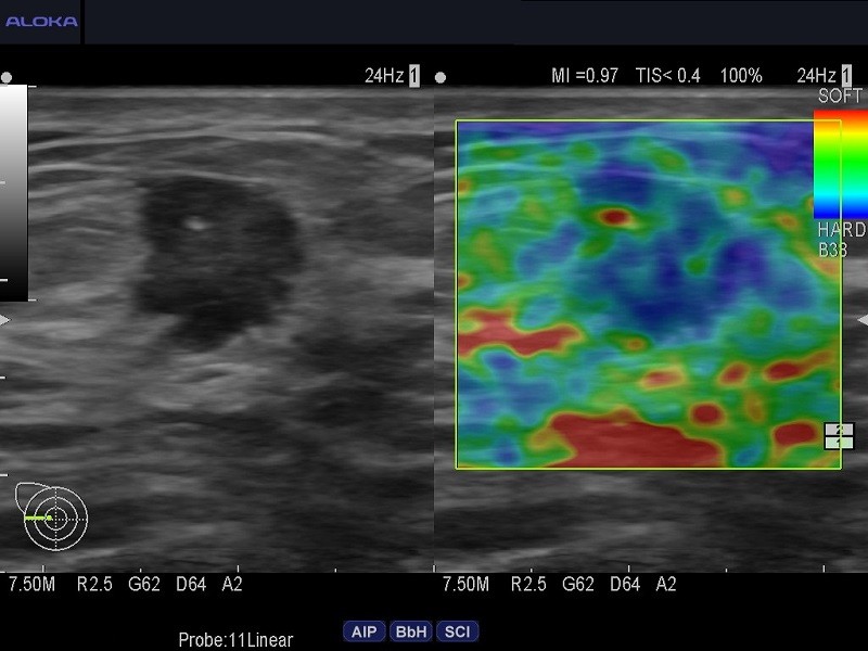 HITACHI PROSOUND F75 | MEDtechnic services s.r.o.