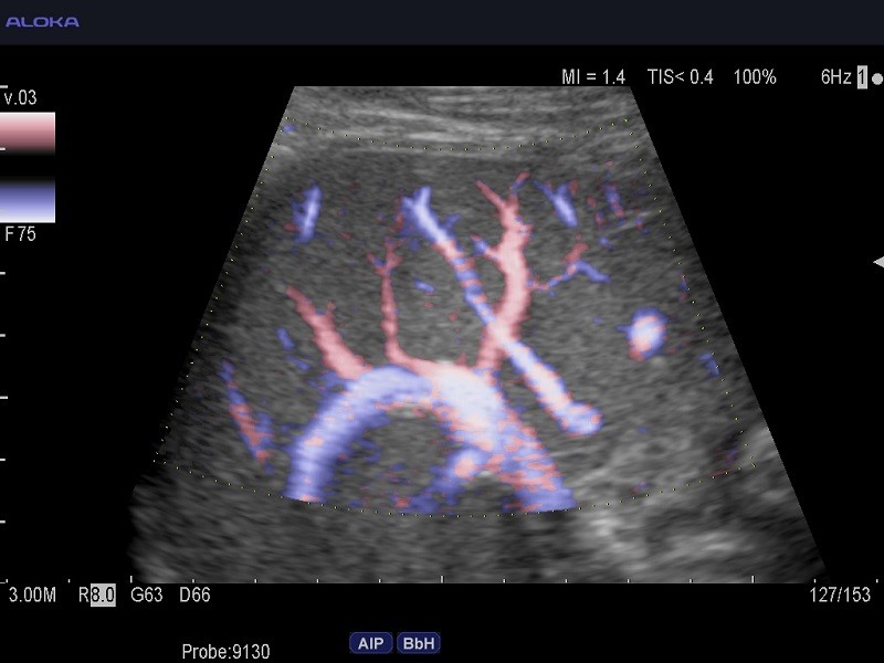 HITACHI PROSOUND F75 | MEDtechnic services s.r.o.