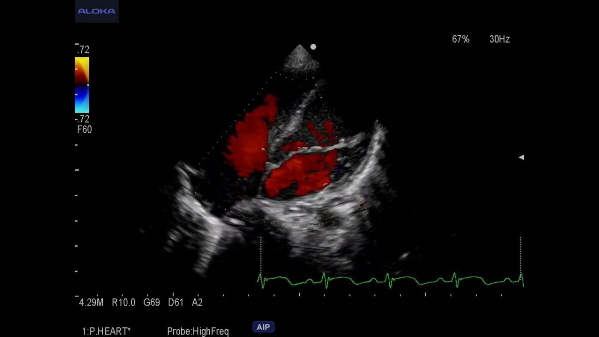 HITACHI PROSOUND F75 | MEDtechnic services s.r.o.