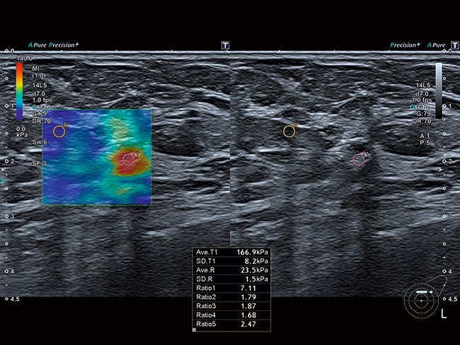 CANON APLIO a550 | MEDtechnic services s.r.o.
