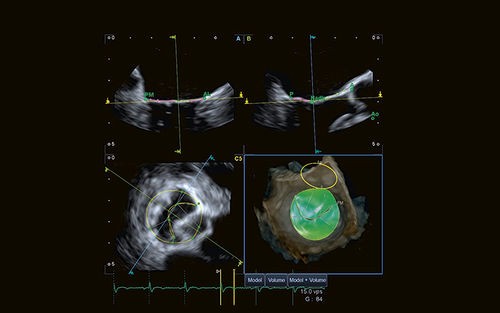 CANON APLIO i900 | MEDtechnic services s.r.o.
