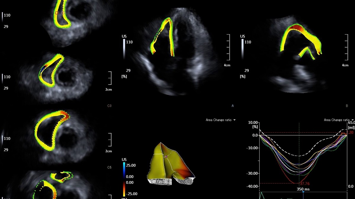 CANON APLIO i900 | MEDtechnic services s.r.o.