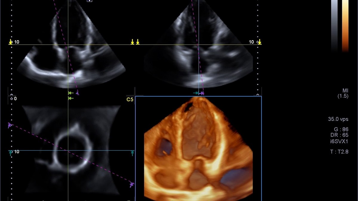 CANON APLIO i900 | MEDtechnic services s.r.o.