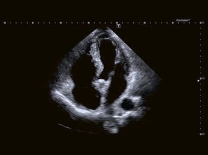 CANON APLIO i600 | MEDtechnic services s.r.o.