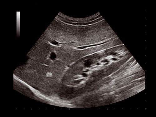 ESAOTE MY LAB 15 | MEDtechnic services s.r.o.