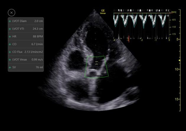 Ge Venue | MEDtechnic services s.r.o.
