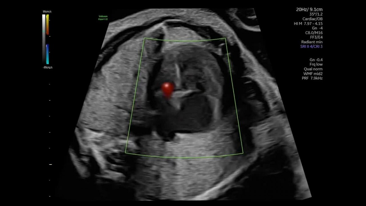 Voluson Expert 22 | MEDtechnic services s.r.o.
