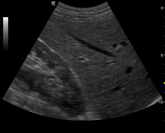 GE LOGIQ C5 | MEDtechnic services s.r.o.