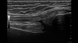 GE LOGIQ FORTIS | MEDtechnic services s.r.o.