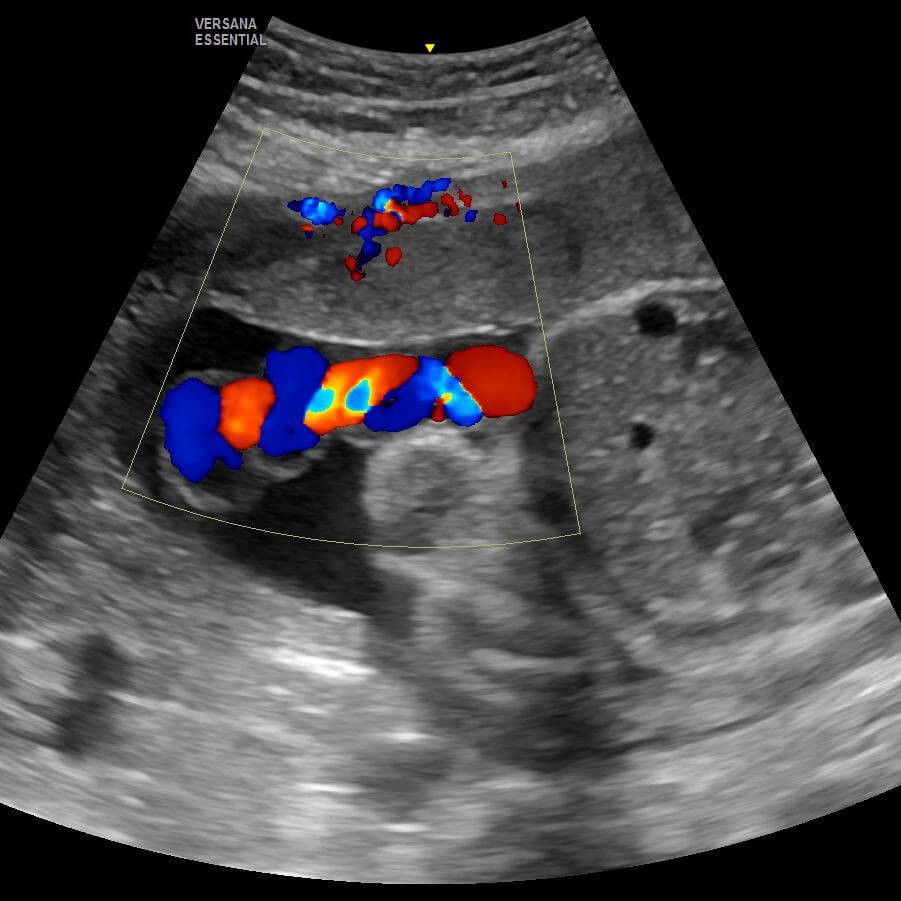 GE VERSANA BALANCE | MEDtechnic services s.r.o.