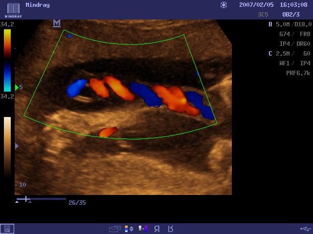 MINDRAY DC6 EXPERT | MEDtechnic services s.r.o.