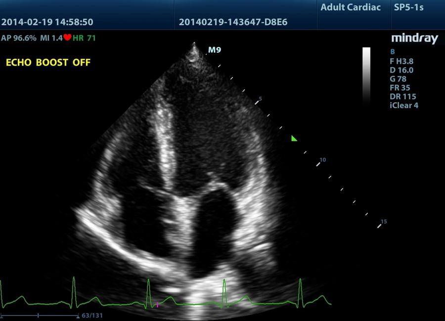 MINDRAY M9 | MEDtechnic services s.r.o.