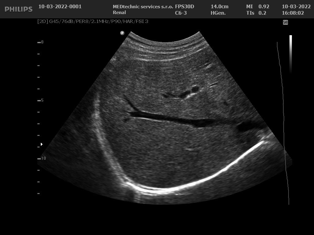 PHILIPS HD9 | MEDtechnic services s.r.o.