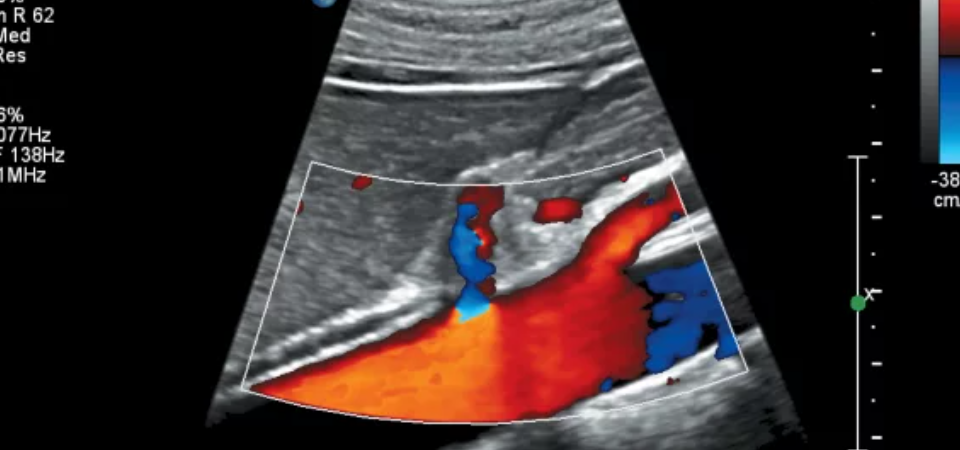 PHILIPS AFFINITY 70G | MEDtechnic services s.r.o.