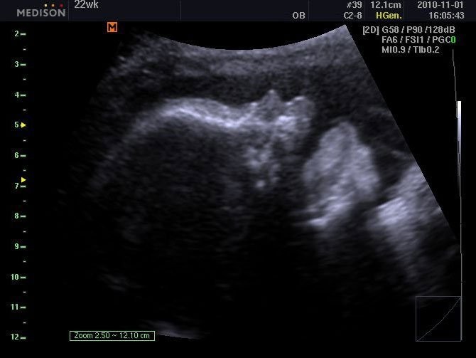 SAMSUNG SONOACE R5 | MEDtechnic services s.r.o.