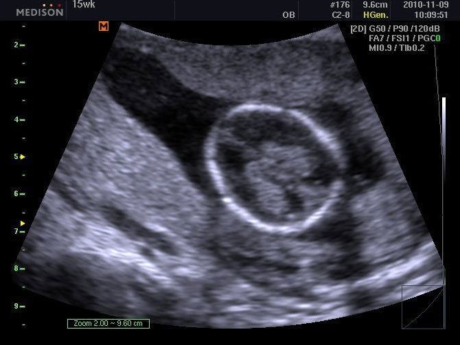 SAMSUNG SONOACE R5 | MEDtechnic services s.r.o.