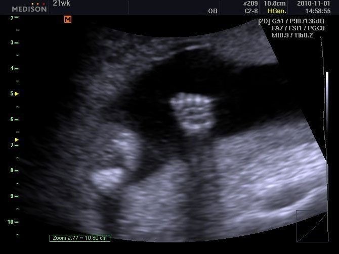 SAMSUNG SONOACE R5 | MEDtechnic services s.r.o.