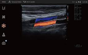 Vinno Q | MEDtechnic services s.r.o.