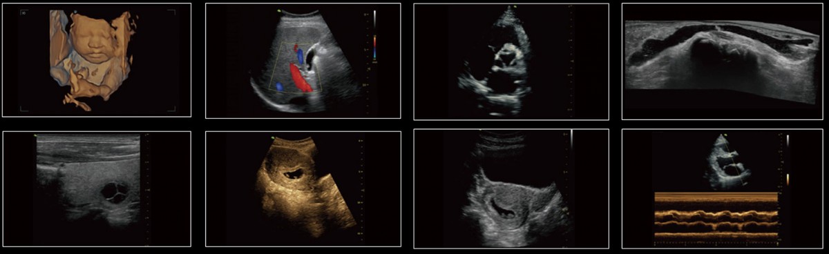 VINNO A6 | MEDtechnic services s.r.o.