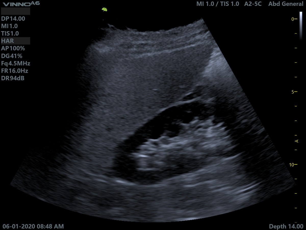 VINNO A6 | MEDtechnic services s.r.o.