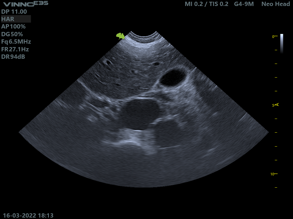 VINNO S300 | MEDtechnic services s.r.o.