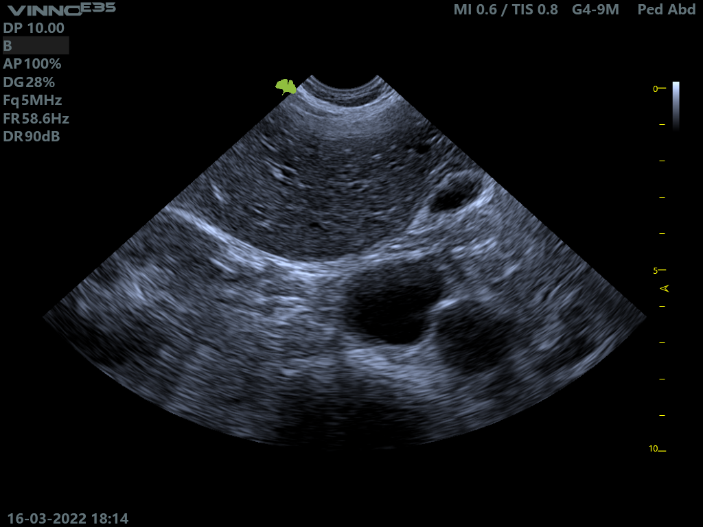 VINNO S300 | MEDtechnic services s.r.o.