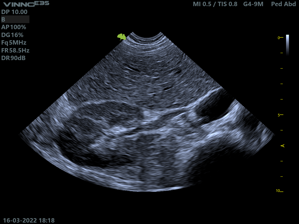 VINNO S300 | MEDtechnic services s.r.o.