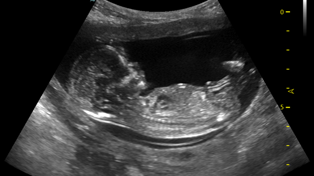 Vinno X2 | MEDtechnic services s.r.o.