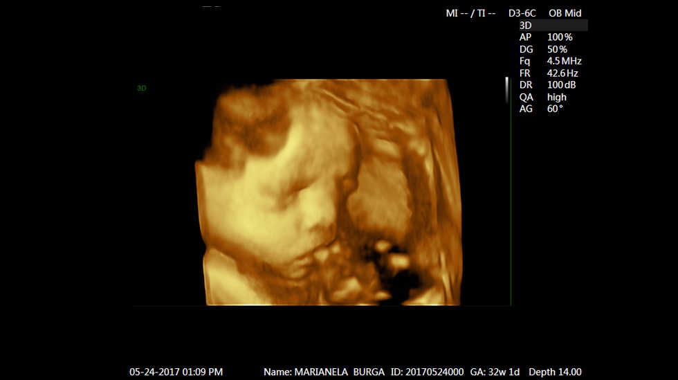 Vinno X2 | MEDtechnic services s.r.o.