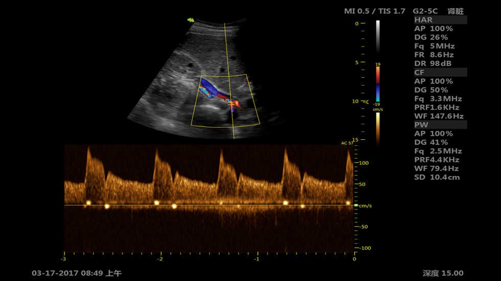 Vinno X2 | MEDtechnic services s.r.o.