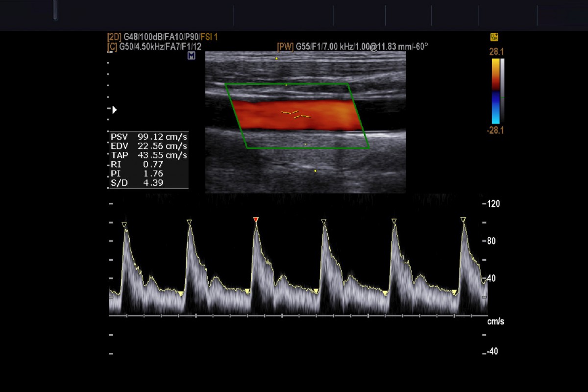 MEDISON Accuvix XG | MEDtechnic services s.r.o.