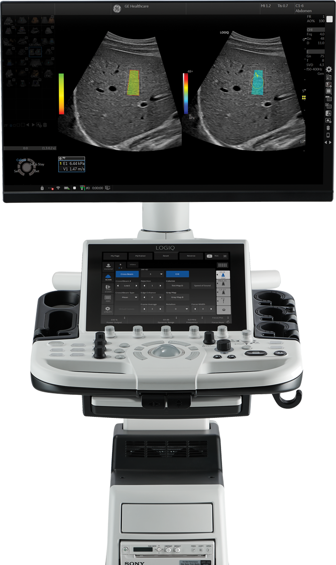 Ultrazvuk LOGIQ P10 XDclear | MEDtechnic services s.r.o.