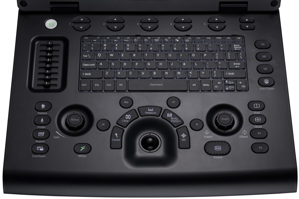 GE VERSANA ACTIVE | MEDtechnic services s.r.o.