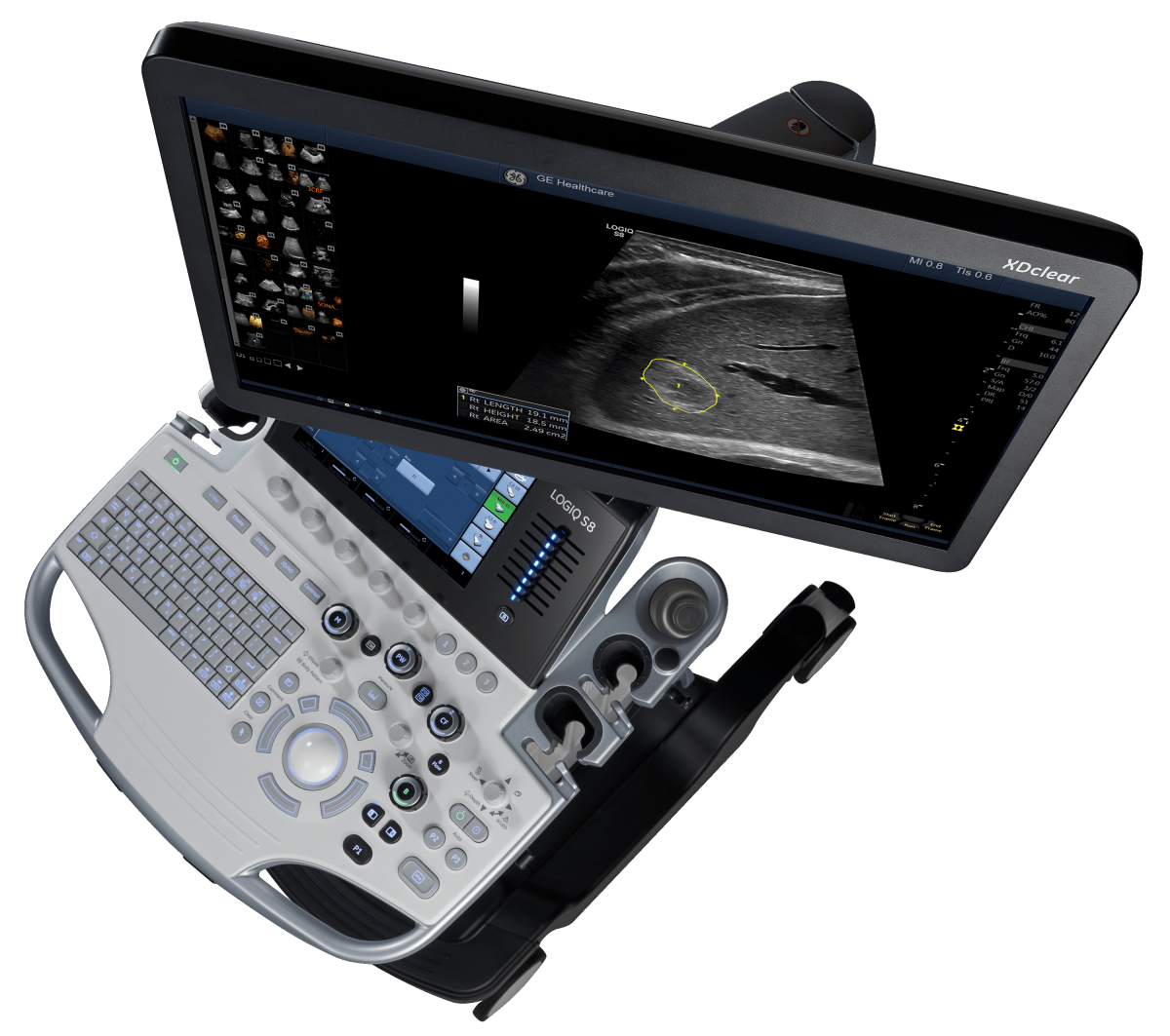 LOGIQ S8 XDclear 2.0+ | MEDtechnic services s.r.o.