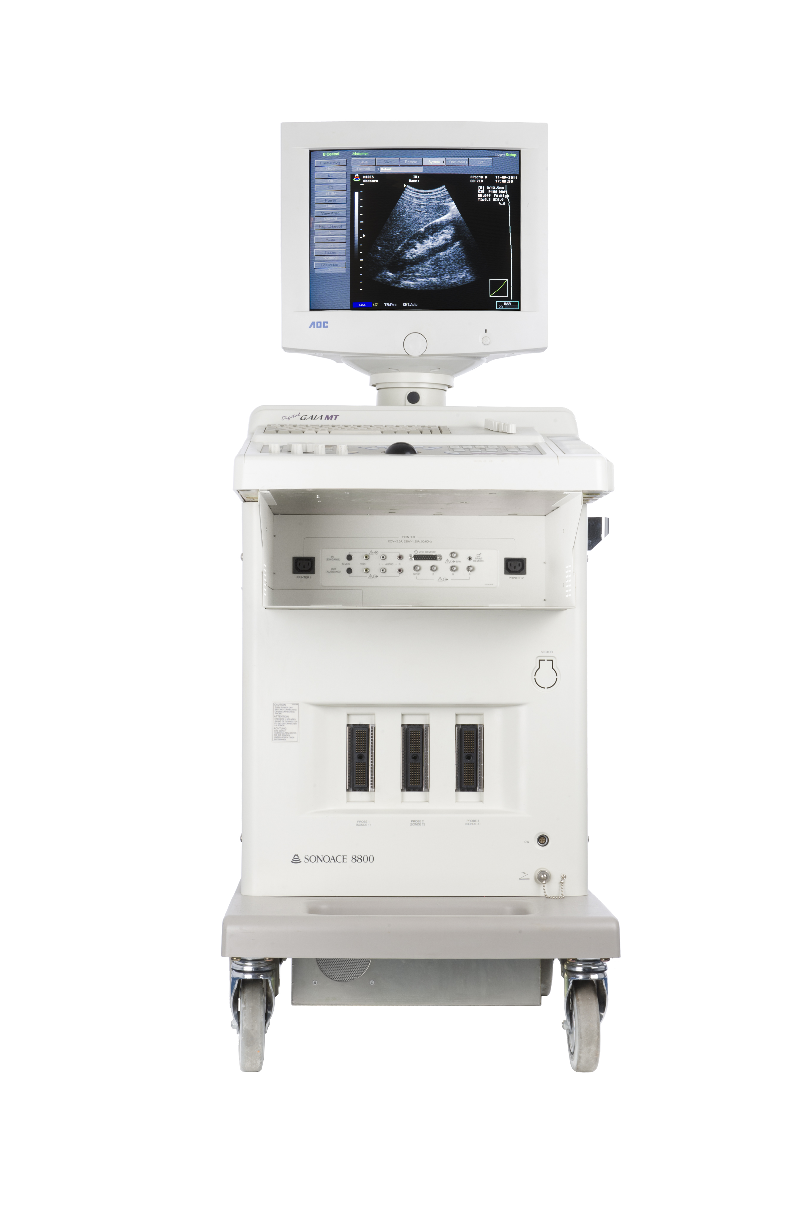 MEDISON SONOACE 8000EX Prime | MEDtechnic services s.r.o.