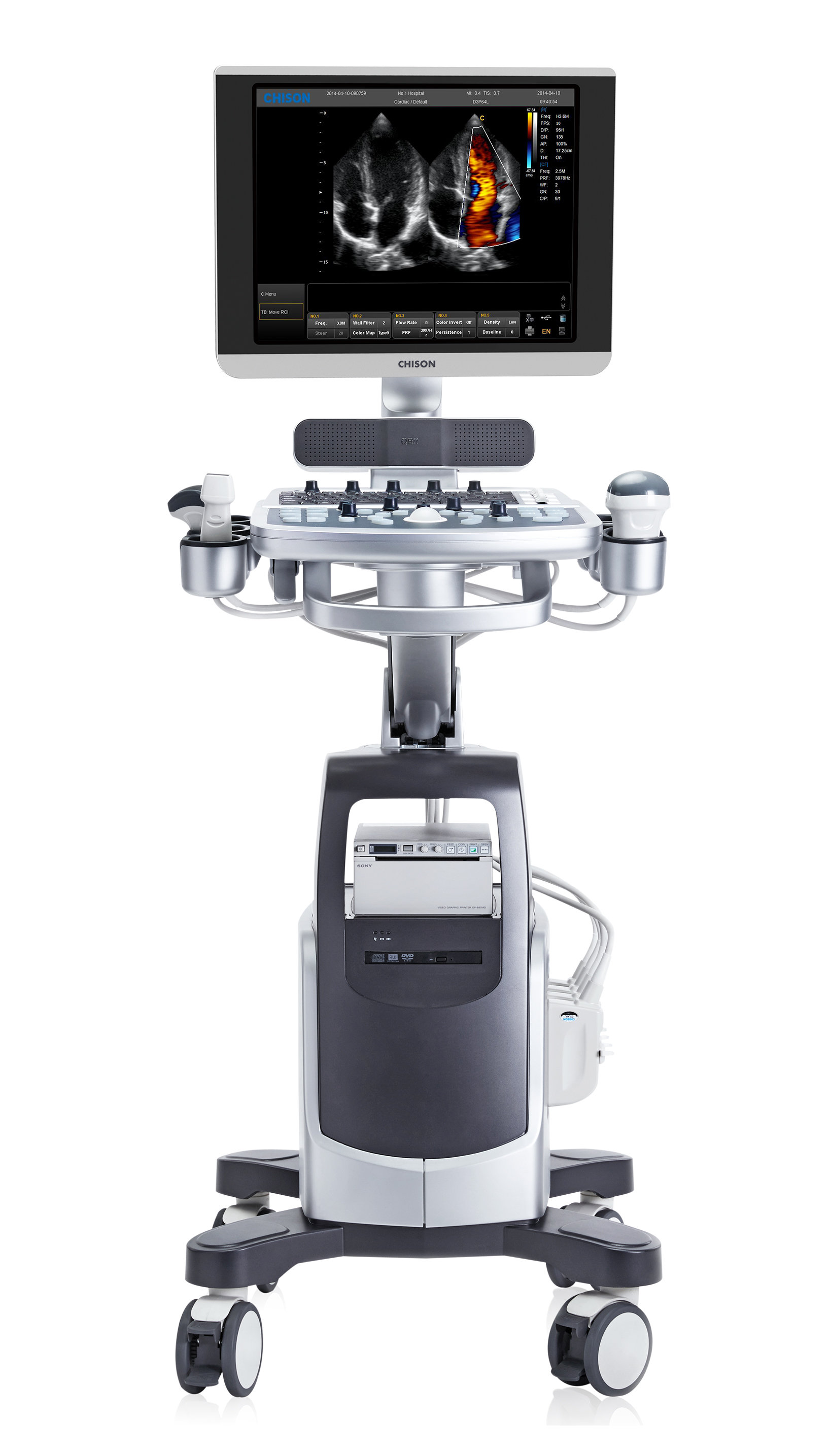 CHISON QBIT 7 | MEDtechnic services s.r.o.