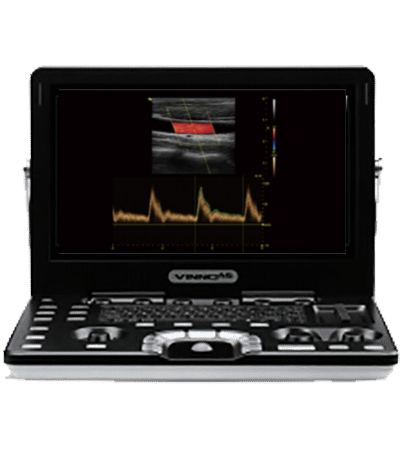 VINNO A6 | MEDtechnic services s.r.o.